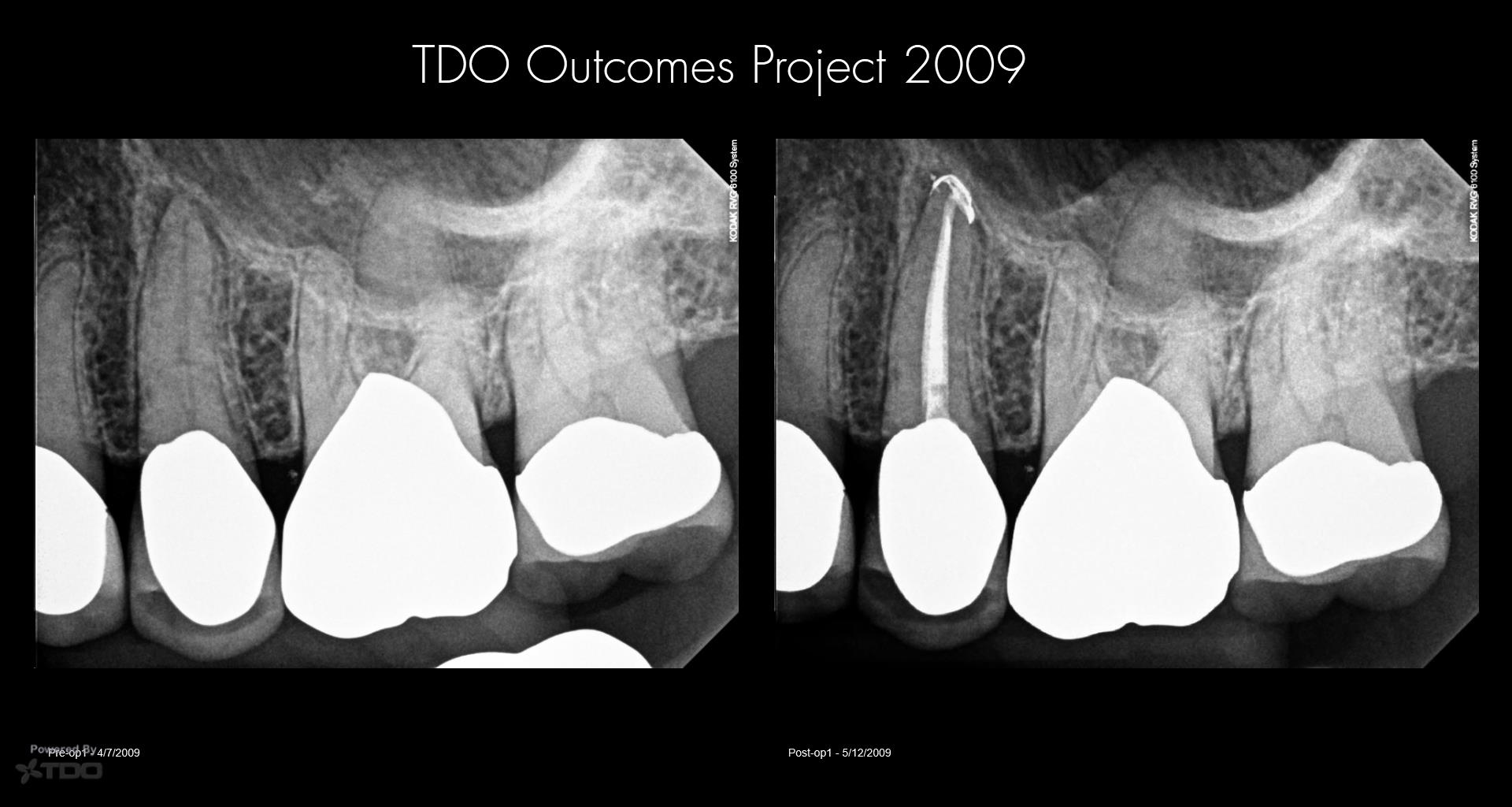 First TDO Outcomes Failure – TDO University