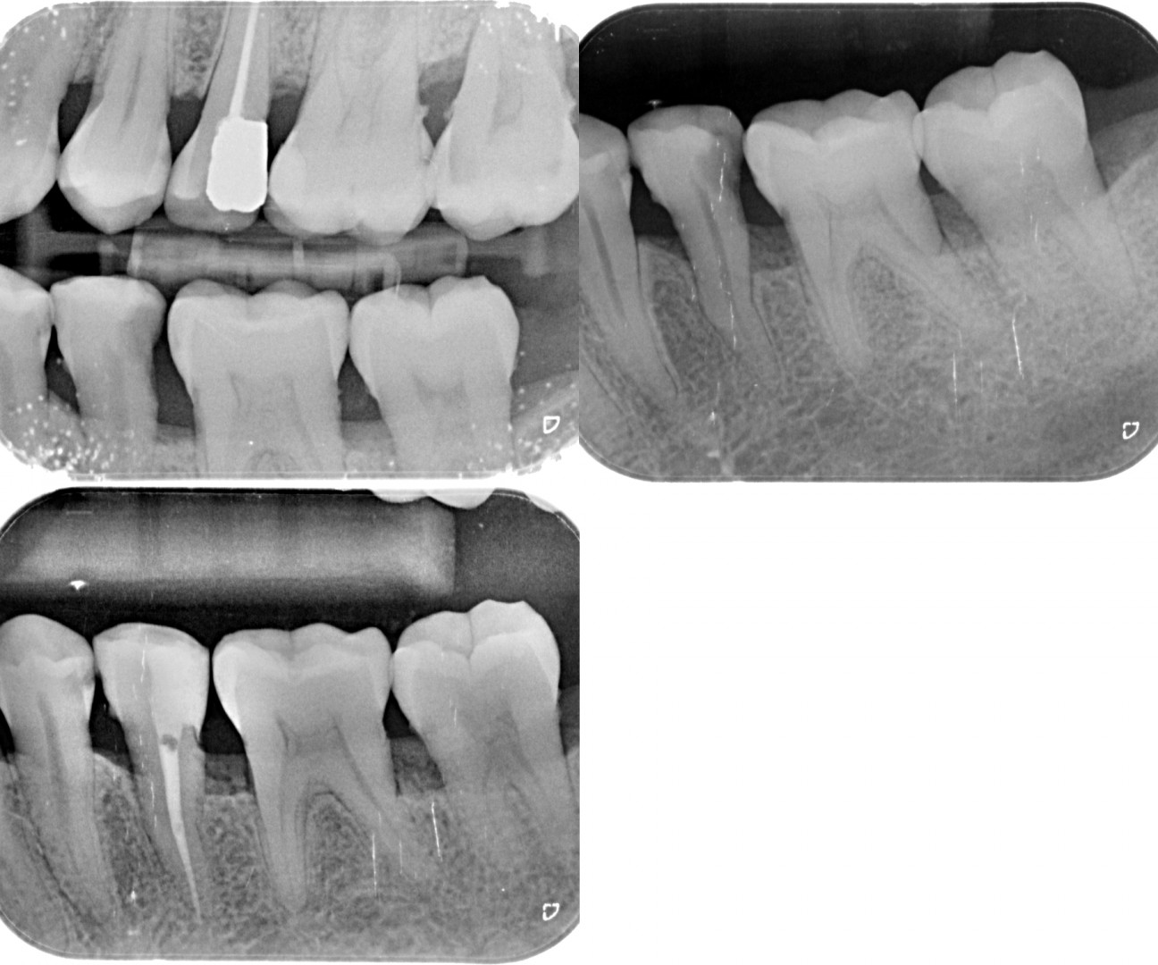 Routine RCT – TDO University