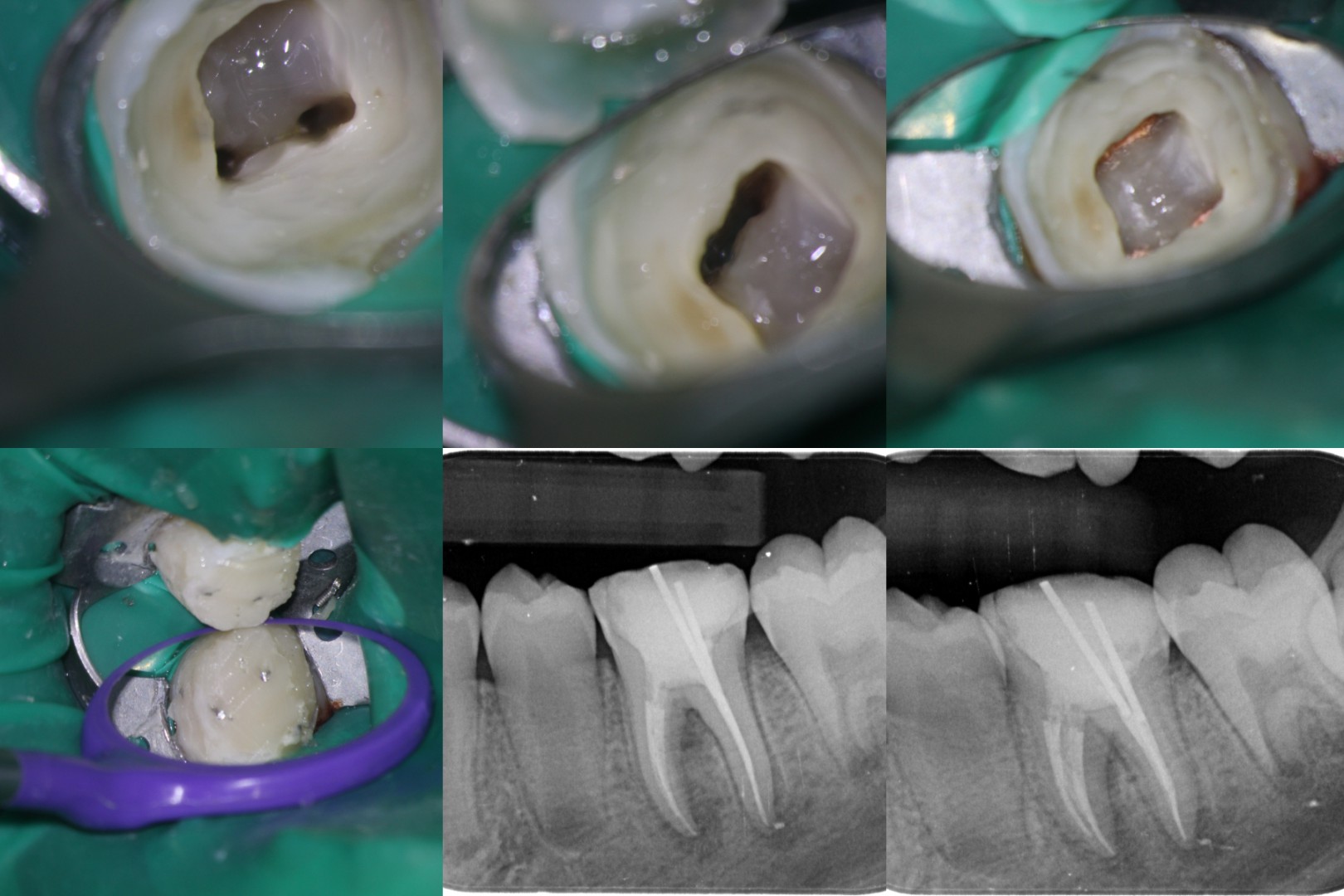 Routine RCT – TDO University