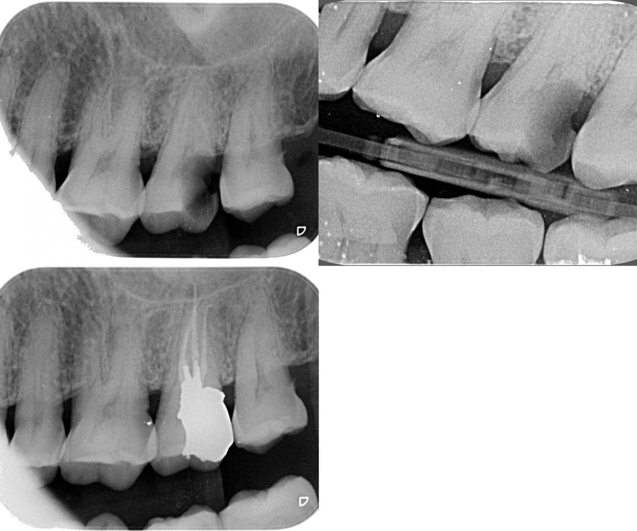 Routine RCT – TDO University