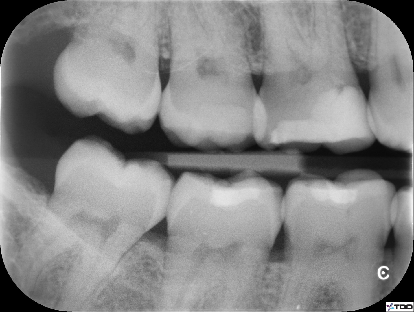 Bioclear #3 composite 1 – TDO University