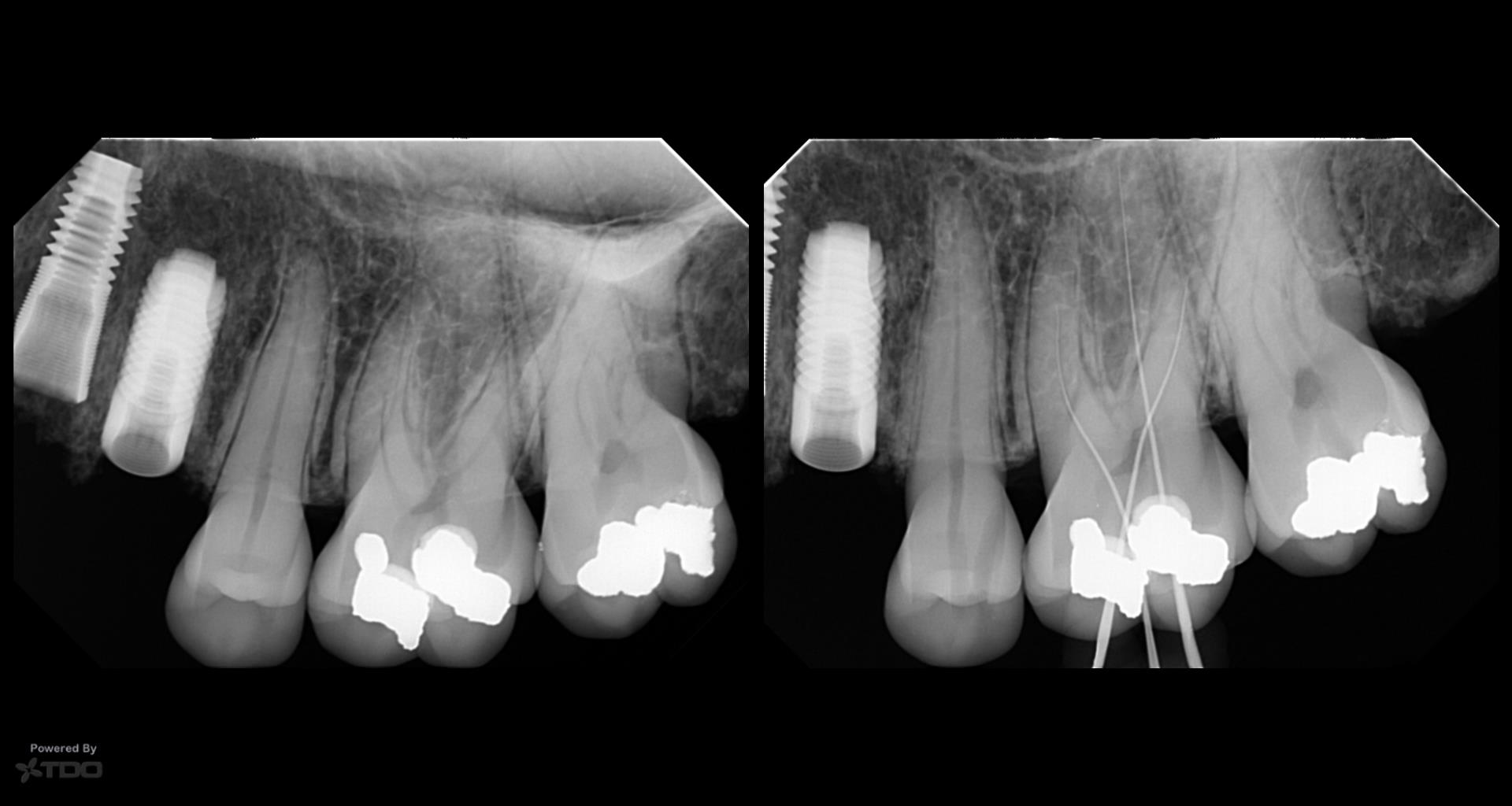 Using TDO Collage and X-Nav – TDO University