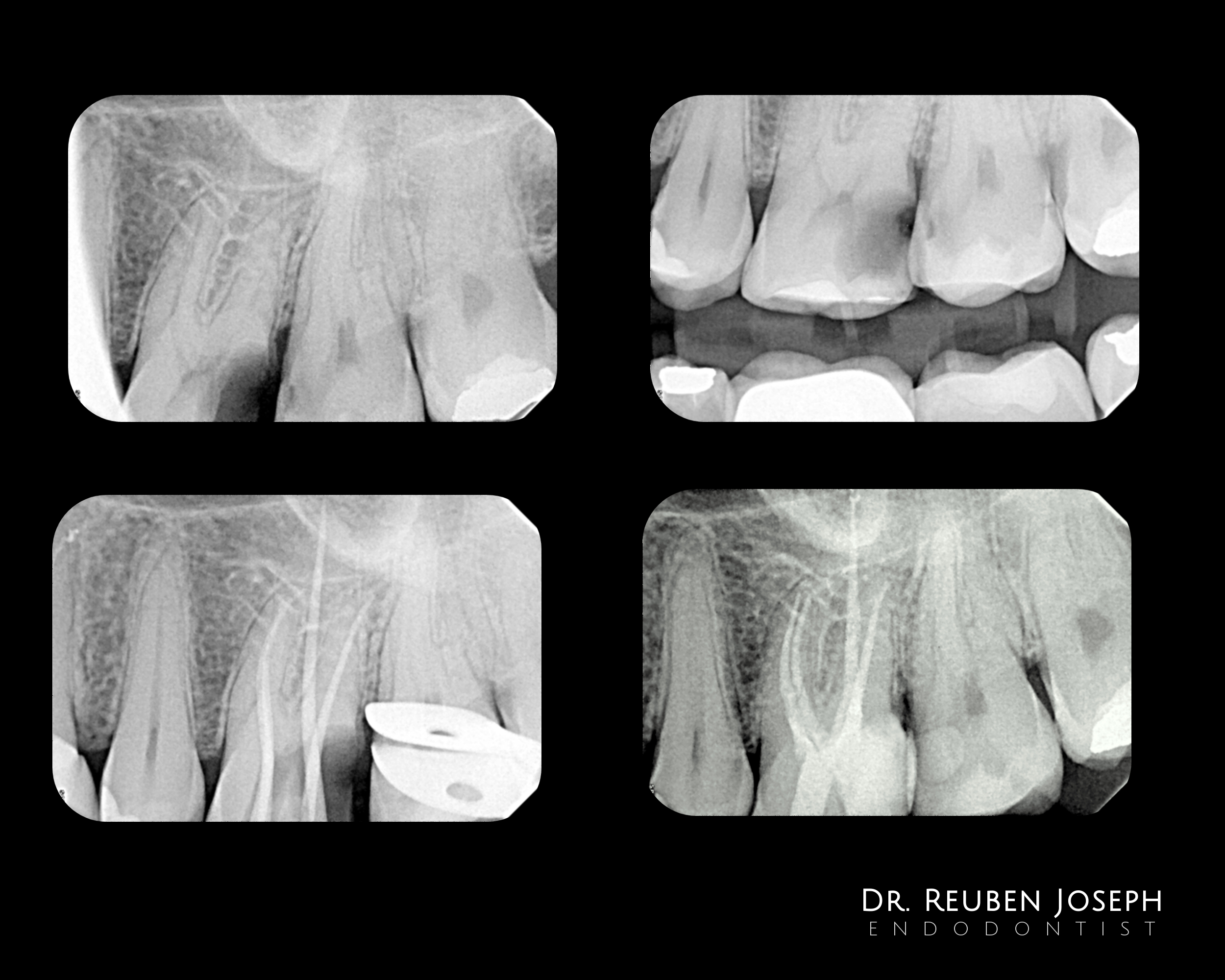 finale – TDO University