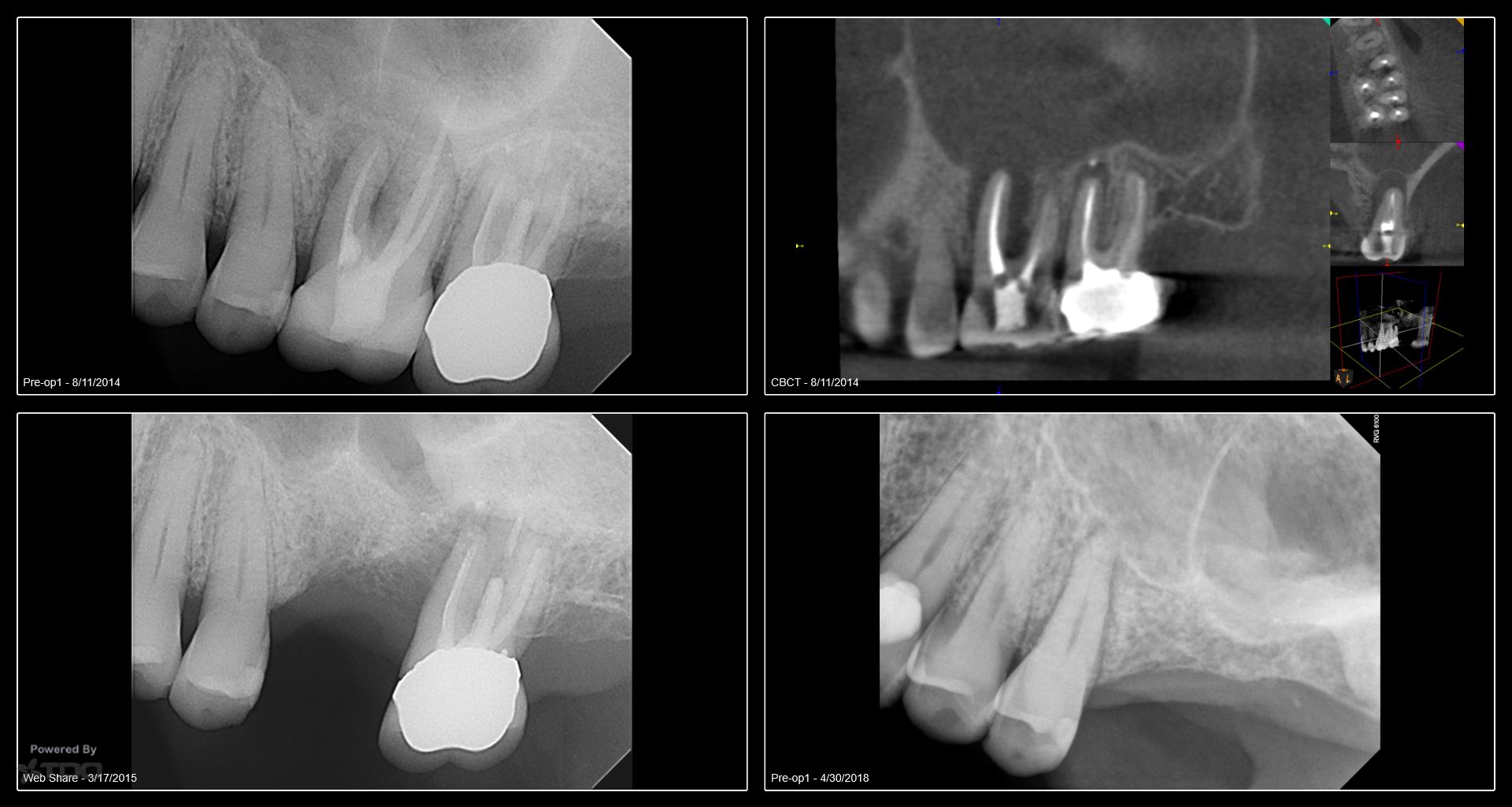Life cycle of teeth – TDO University