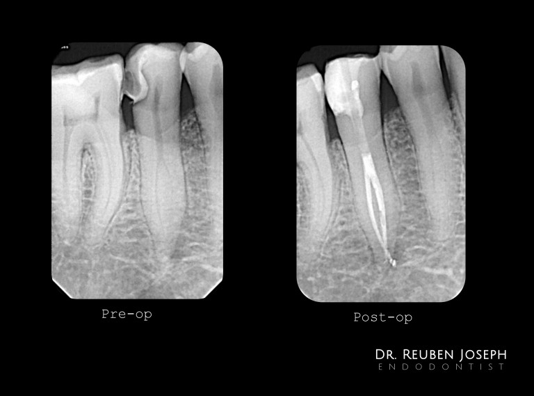 iopa – TDO University