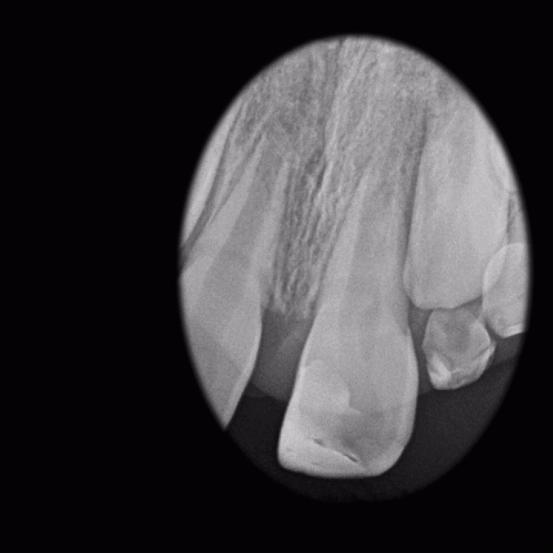 Trauma regendo gif – TDO University