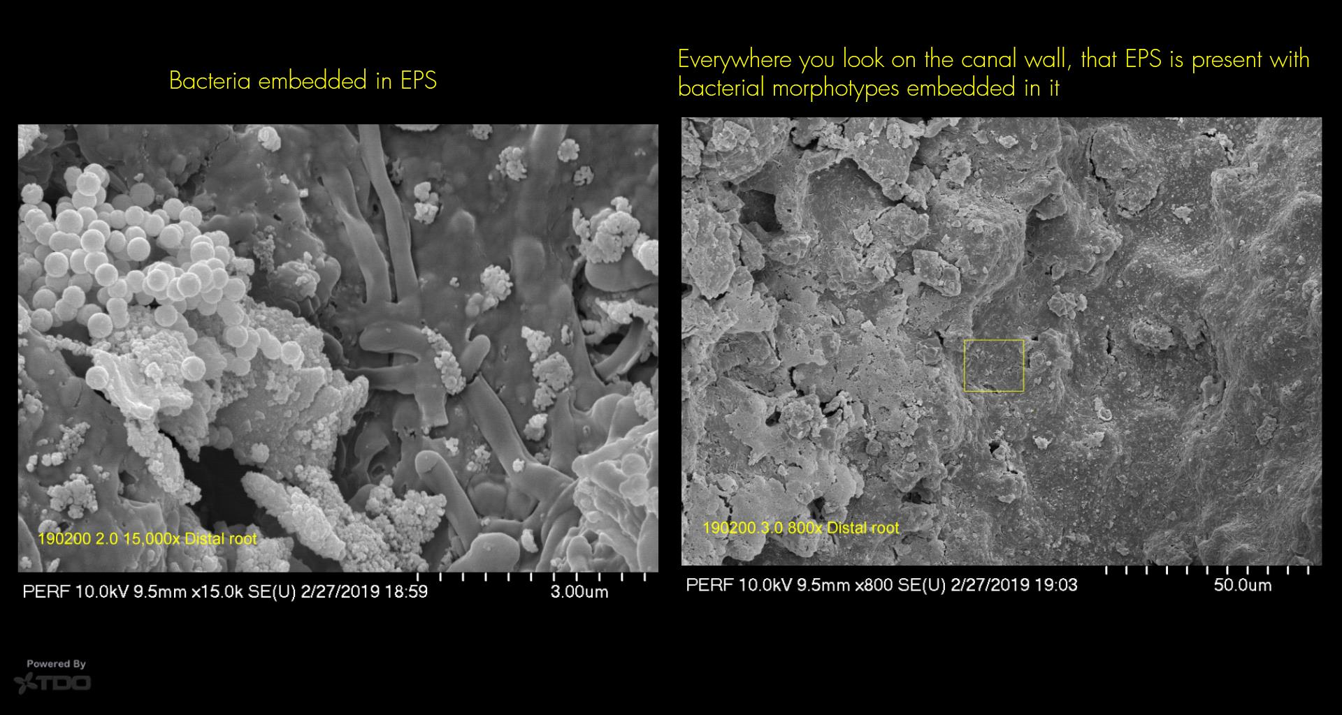 How to detect a biofilm – TDO University