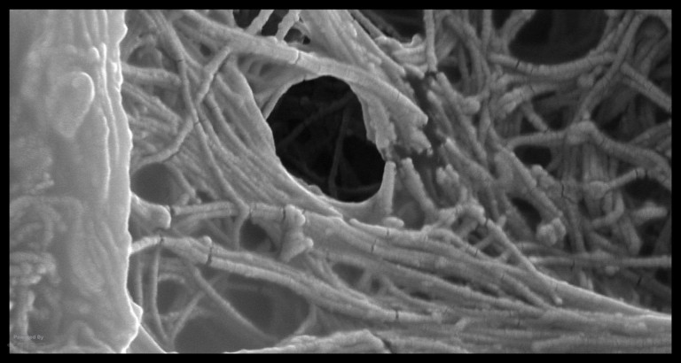 “calcospherites” – TDO University