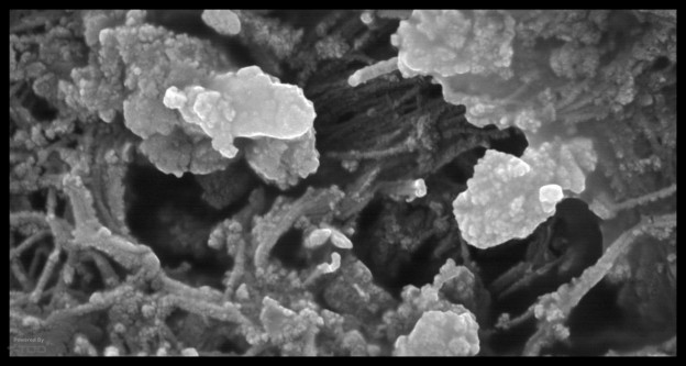 “calcospherites” – TDO University