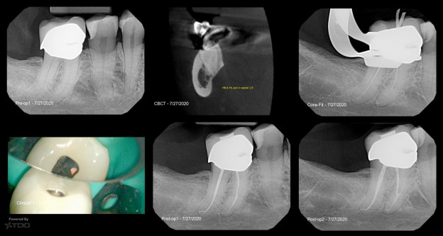 TDO University – Online Endodontic Education