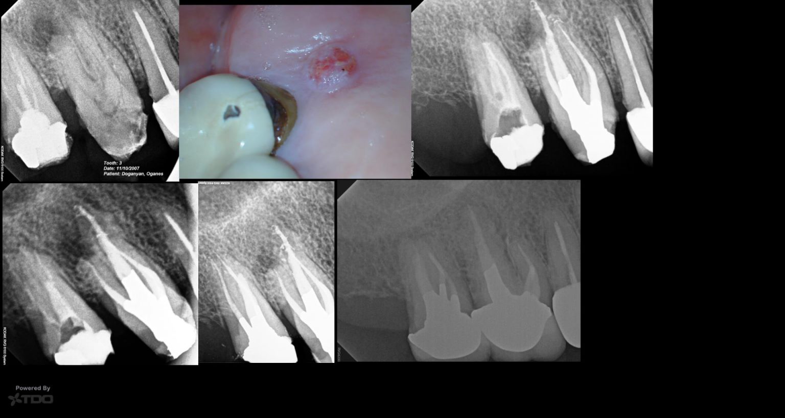 TDO University – Online Endodontic Education